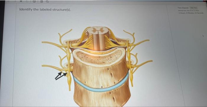 Solved Identify the labeled structure(s). | Chegg.com