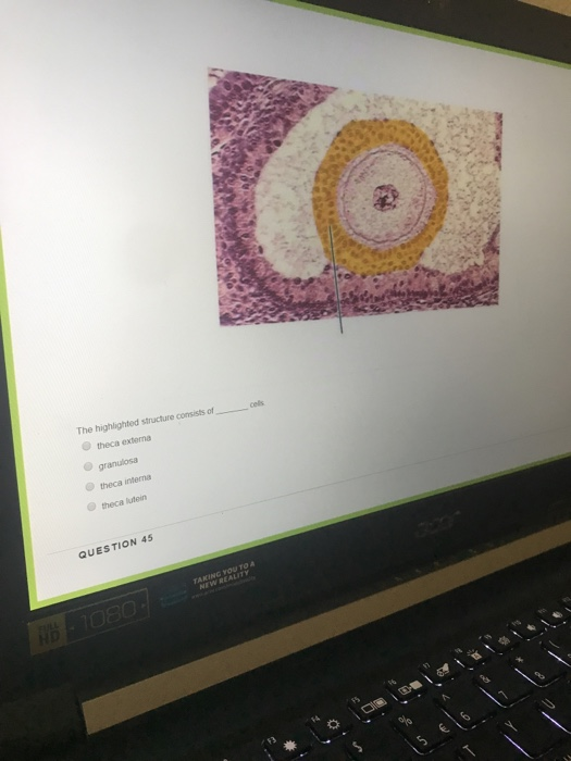 Solved The highlighted structure consists of theca externa | Chegg.com