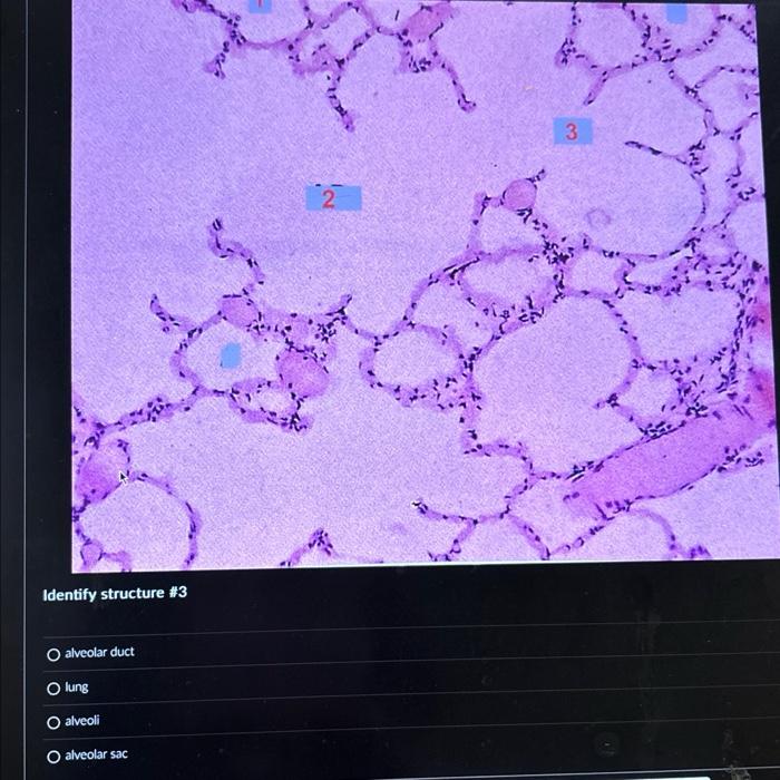 Solved Identify structure \#3 alveolar duct lung alveoli | Chegg.com