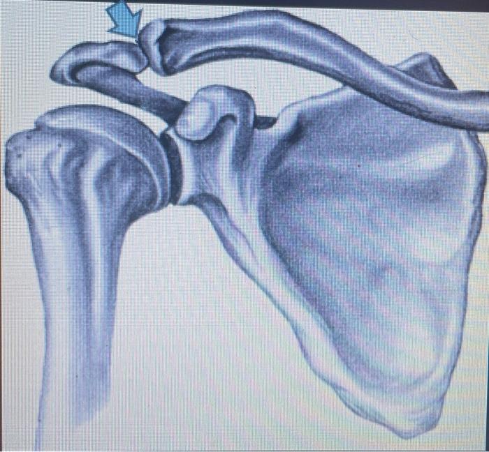Solved Kinesiology. Name this Joint and a ligament that | Chegg.com