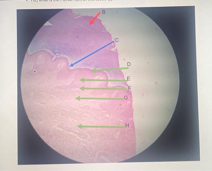 Solved 1. Looking at the entire photomicrograph, what is the | Chegg.com