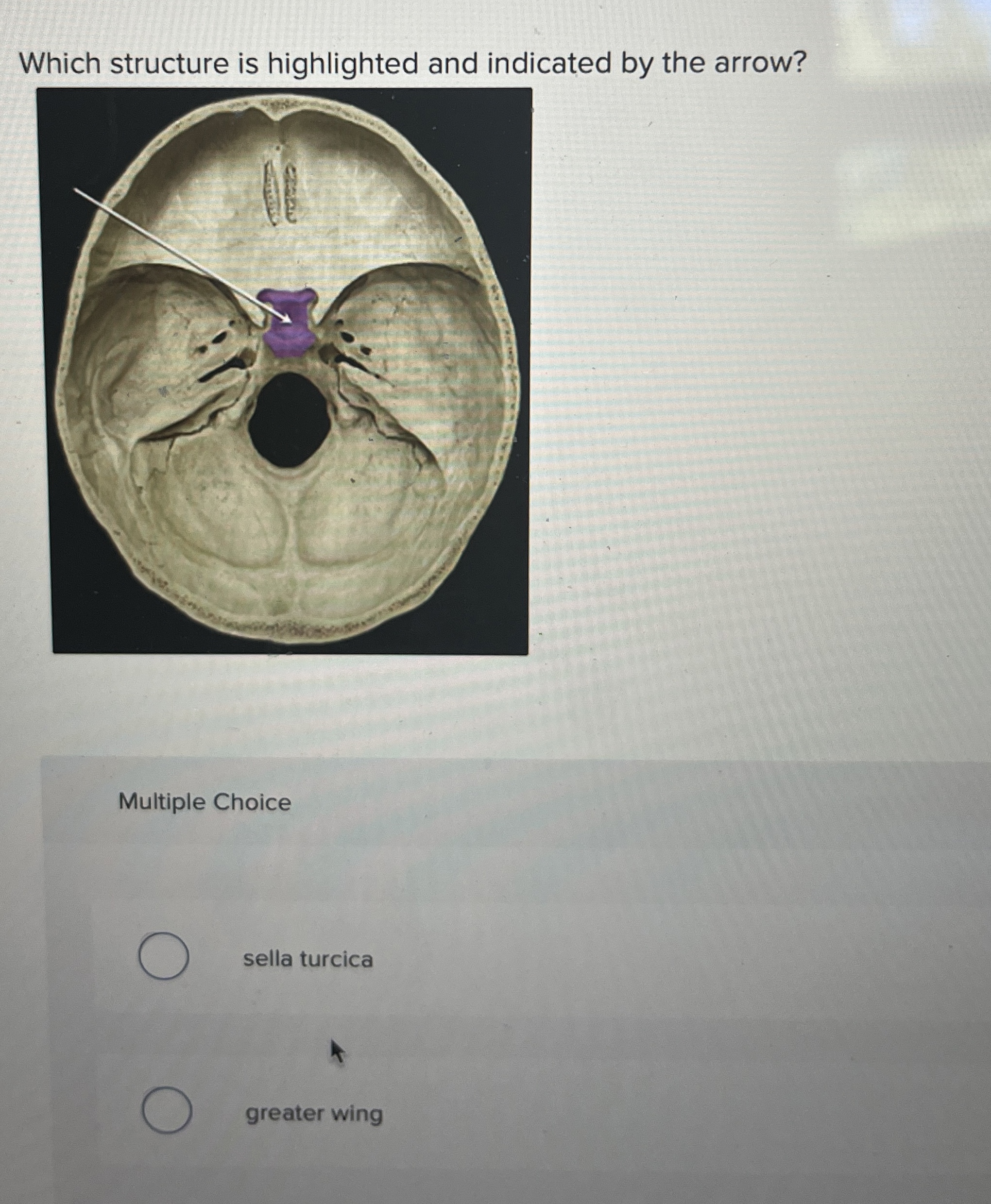 Solved Which structure is highlighted and indicated by the | Chegg.com