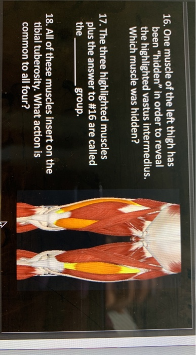 Solved 1. What is the name of the yellow highlighted muscle? | Chegg.com