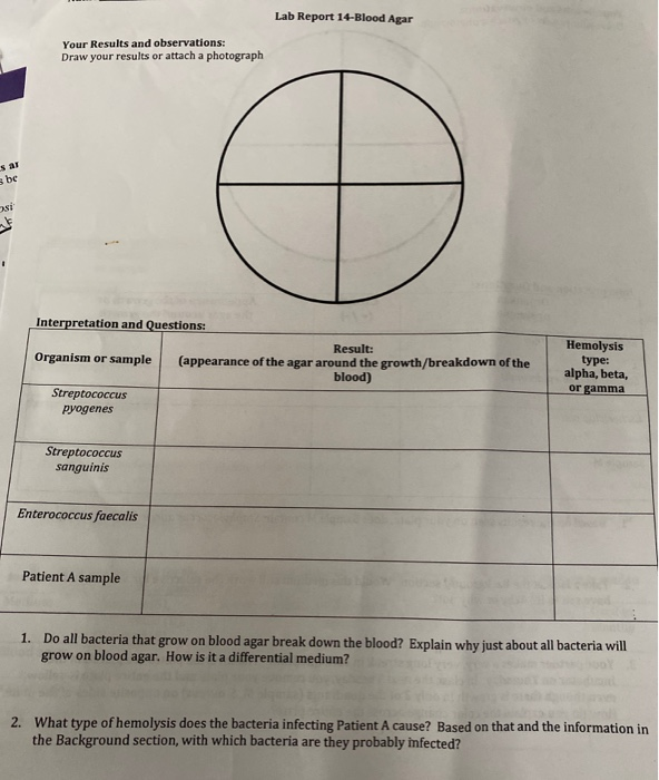 Lab Report 14-Blood Agar Your Results and | Chegg.com
