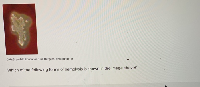 Mannitol salt agar is a diagnostic test used to | Chegg.com