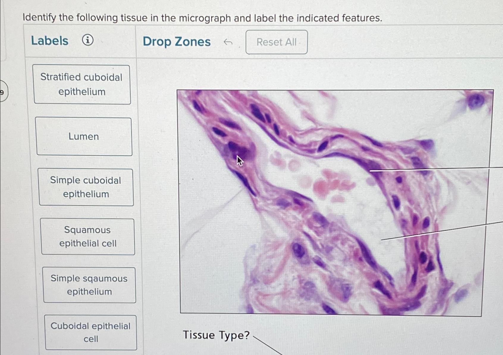 Solved Identify the following tissue in the micrograph and | Chegg.com