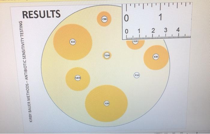 Solved Results: Table 1. Zone Size Interpretation Chart and | Chegg.com