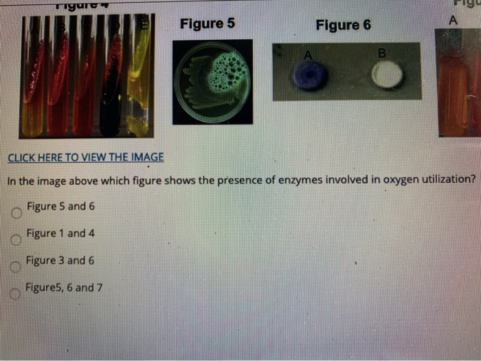 Solved STION Figure 1 B C D E Figure 2 IMVIC Test - Organism | Chegg.com