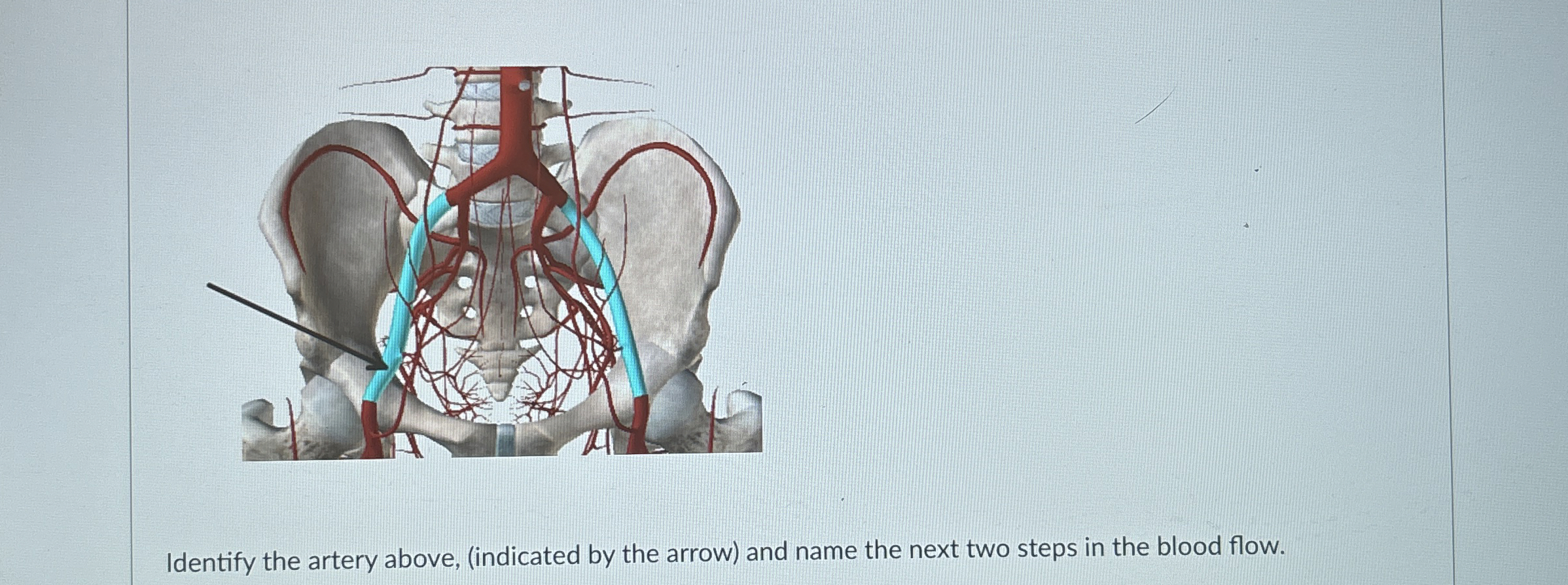Solved Identify the artery above, (indicated by the arrow) | Chegg.com