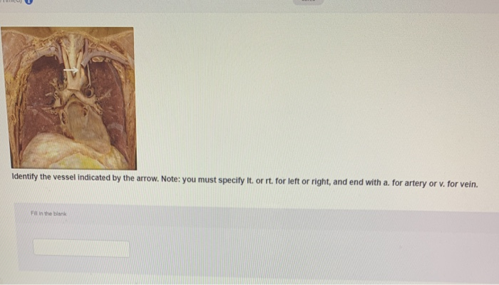 Solved Identify the vessel indicated by the arrow. Note: you | Chegg.com