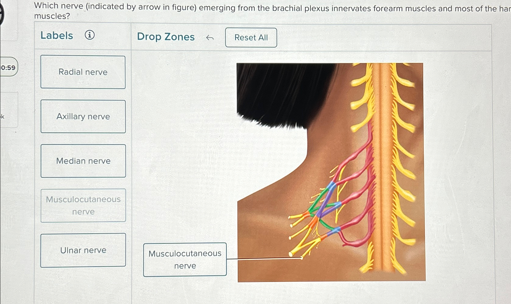 Solved Which nerve (indicated by arrow in figure) ﻿emerging | Chegg.com