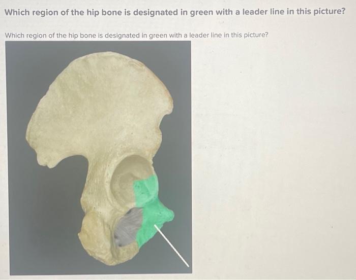 Solved Which region of the hip bone is designated in green | Chegg.com