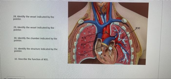 Solved 28. Identify the vessel indicated by the pointer 29. | Chegg.com
