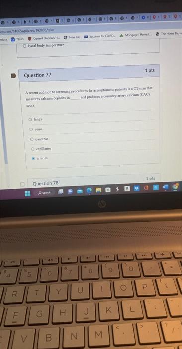 treaures catchan deposits in isoie. atries: | Chegg.com