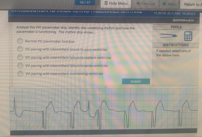 Solved Analyze this VVI pacemaker strip. Identify any | Chegg.com