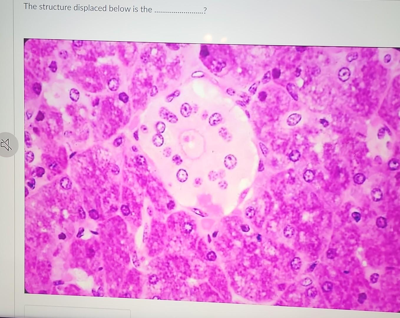 Solved The structure displaced below is the ? | Chegg.com