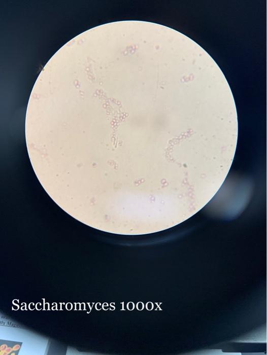 Solved Penicillium 1000x Saccharomyces