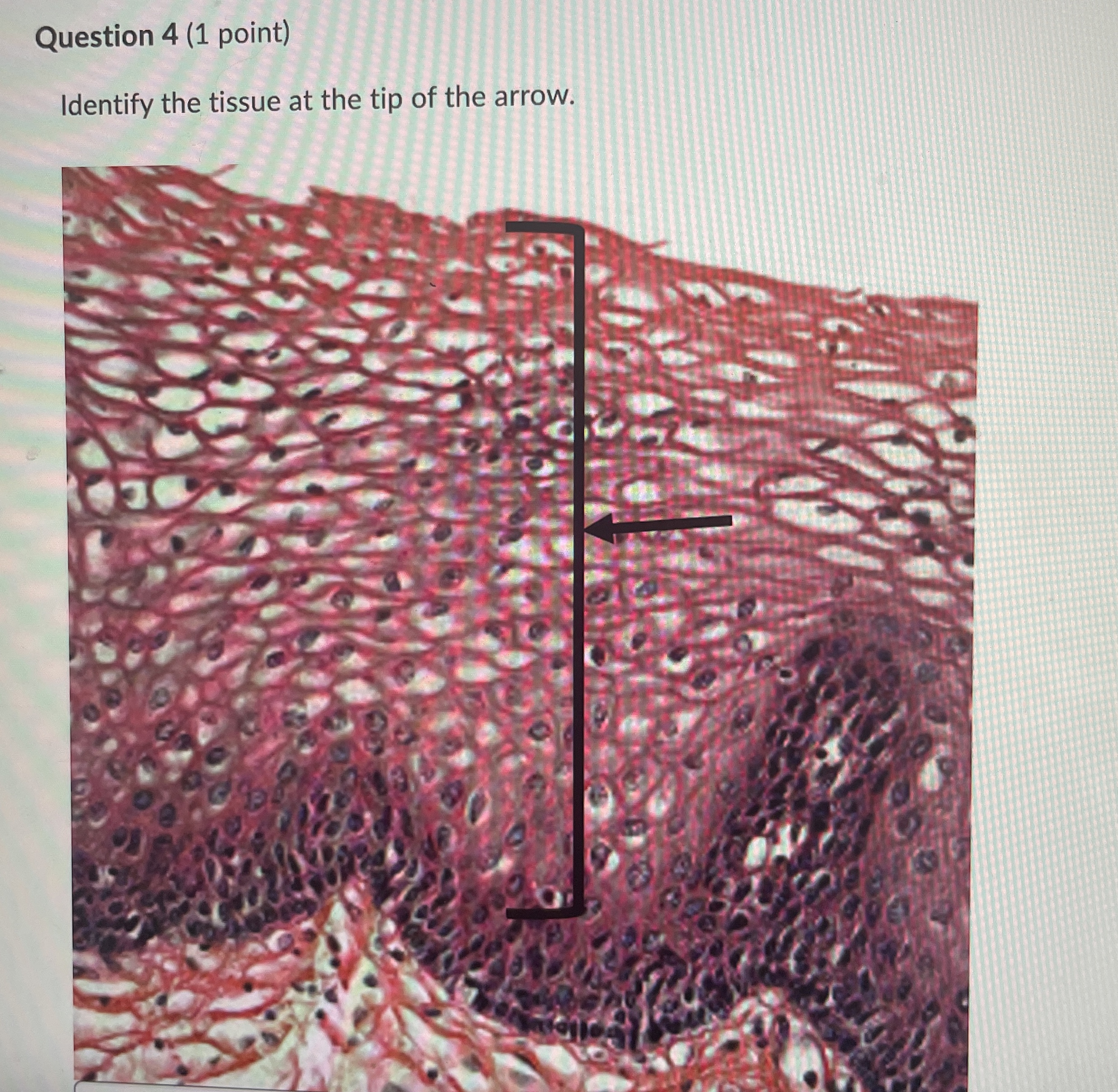 Solved Question 4 (1 ﻿point)Identify the tissue at the tip | Chegg.com