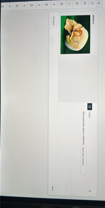 Solved Midterm 11. 1 point This area of the skull is called | Chegg.com