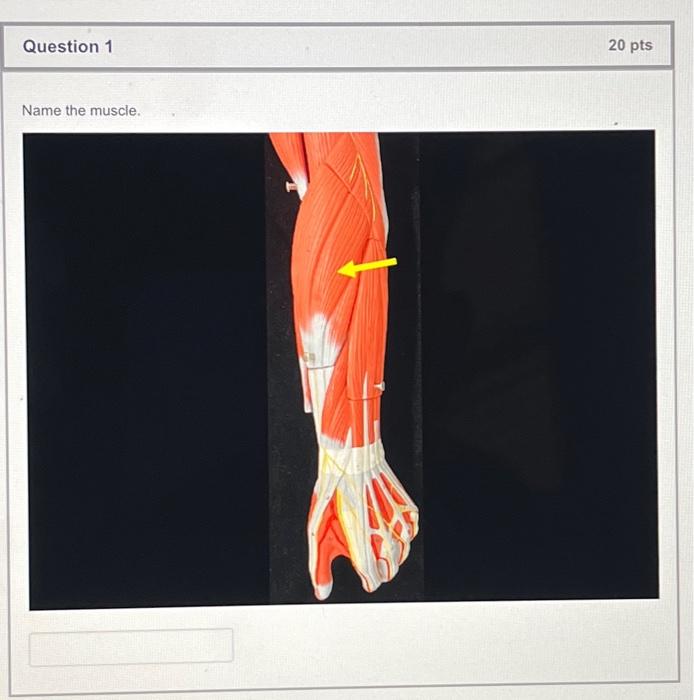 Solved Name the muscle. | Chegg.com