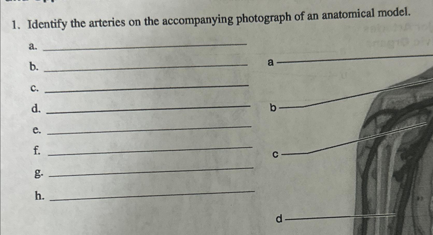 Solved Identify the arteries on the accompanying photograph | Chegg.com