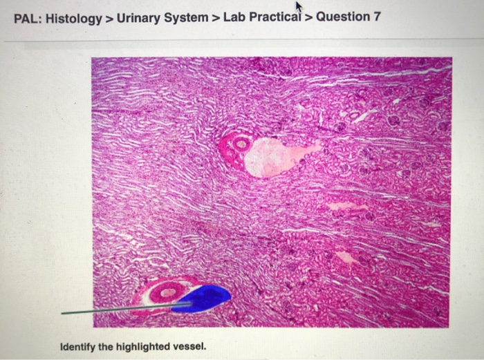 Solved PAL: Histology > Urinary System > Lab Practical > | Chegg.com