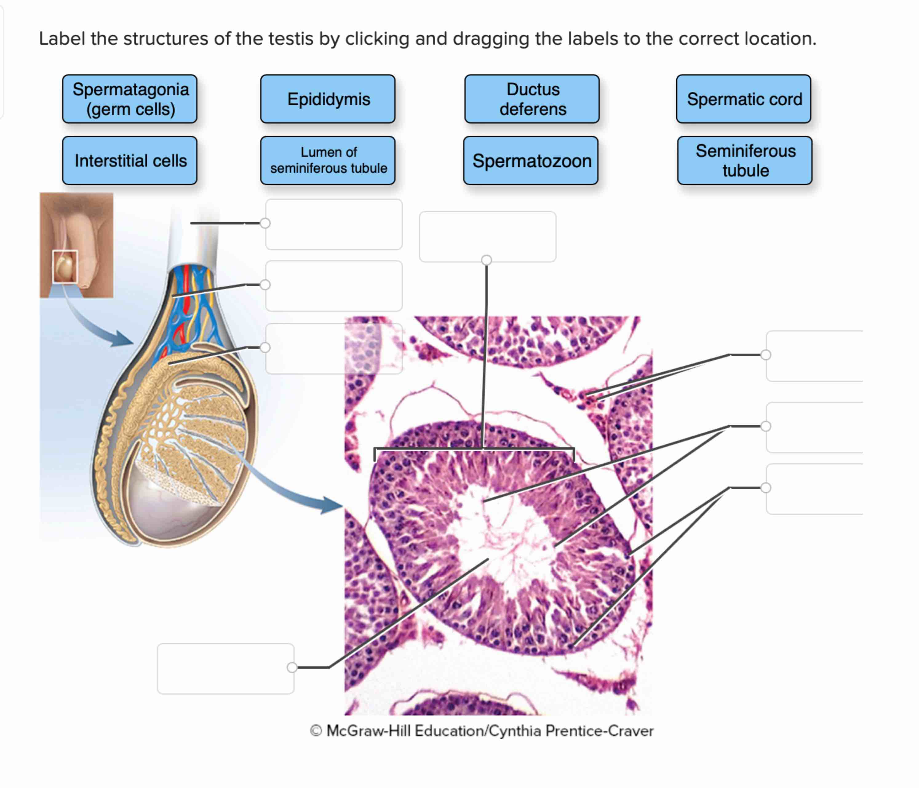 Label the structures of the testis by clicking and | Chegg.com