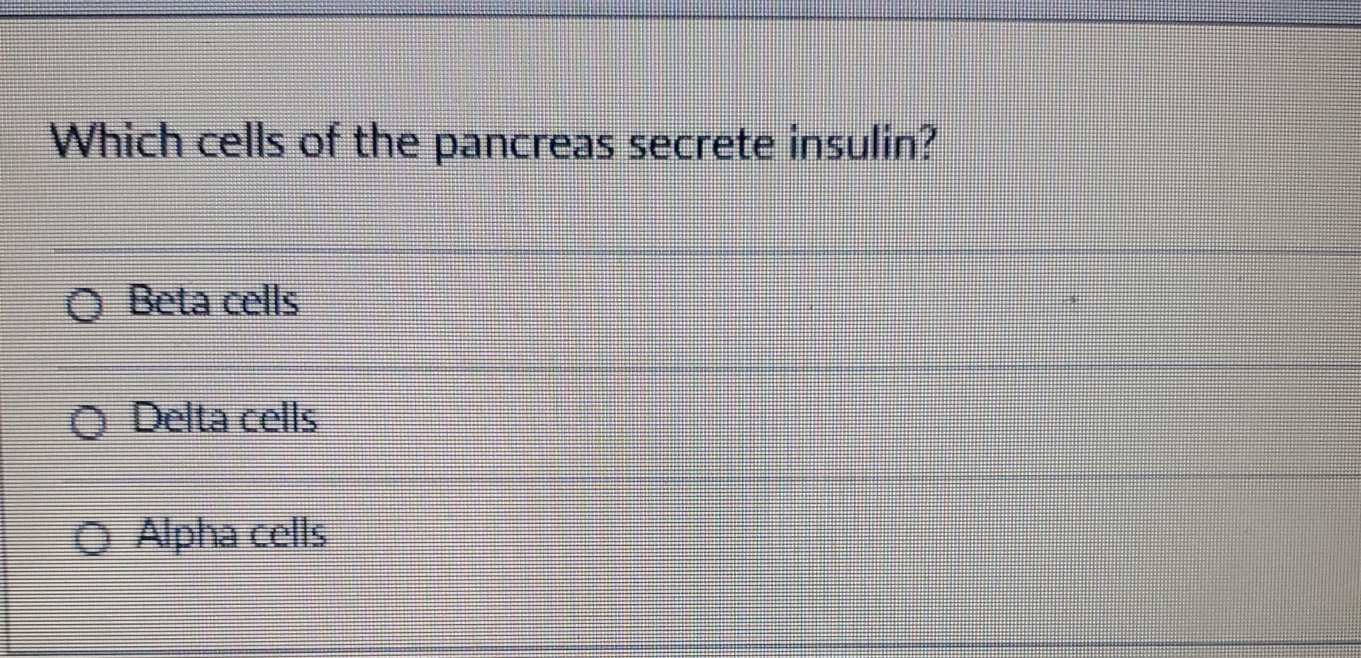 Solved Which cells of the pancreas secrete insulin?Beta | Chegg.com