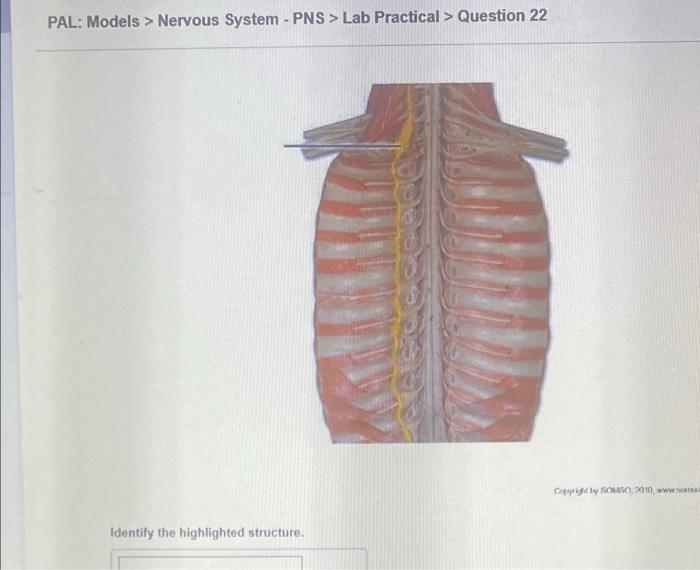 PAL: Models > Nervous System - CNS > Lab Practical > | Chegg.com