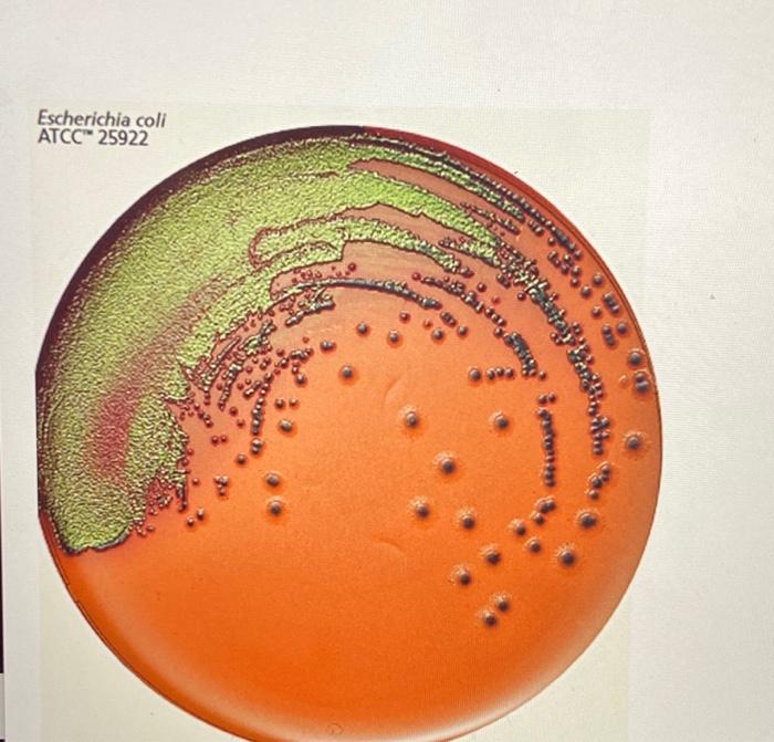 Solved Escherichia coli ATCC 25922 1 E. coli P. aeruginosa | Chegg.com