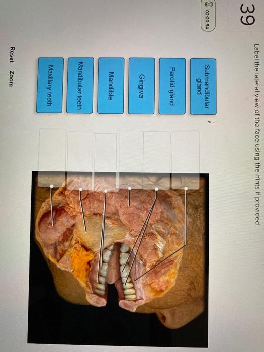 Solved Label the lateral view of the face using the hints if | Chegg.com