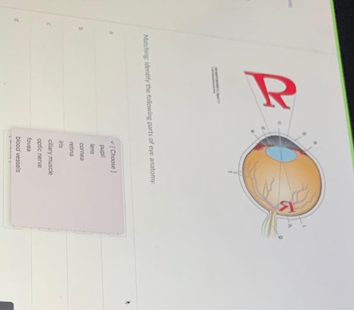 Solved Matching identify the following parts of eye anatomy. | Chegg.com