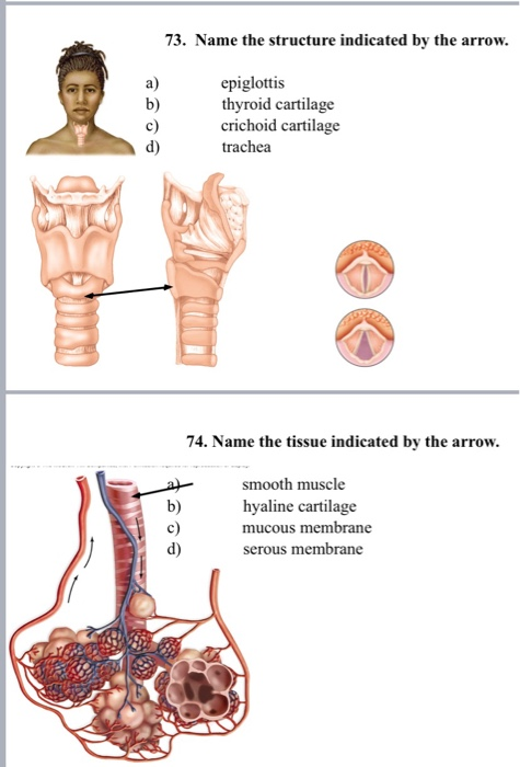 Solved 73. Name the structure indicated by the arrow. | Chegg.com