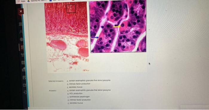 Solved select all that are true about the acidophilic cells | Chegg.com