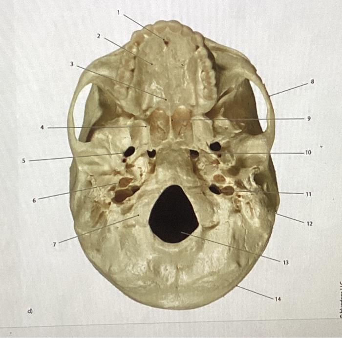 Solved 1 Foramen ovale 2 ≡ Median palatine suture 3 \# | Chegg.com