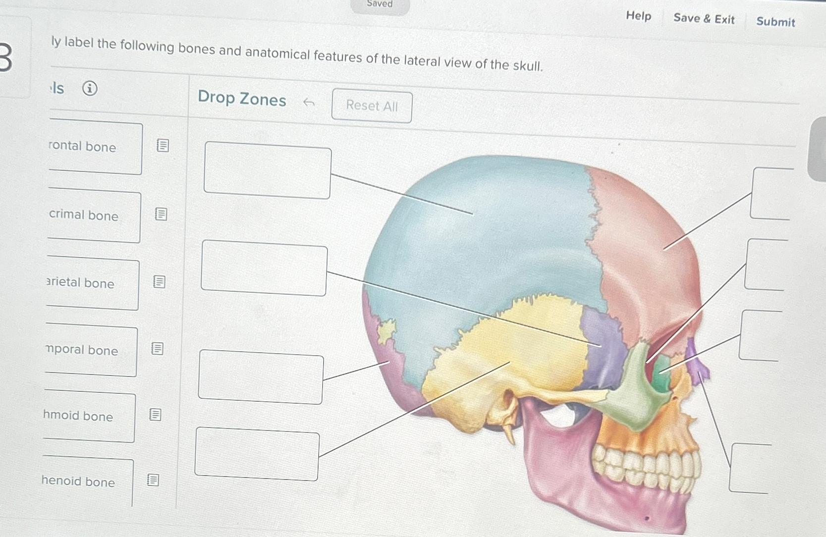 Solved HelpSave & ExitSubmitly label the following bones and | Chegg.com