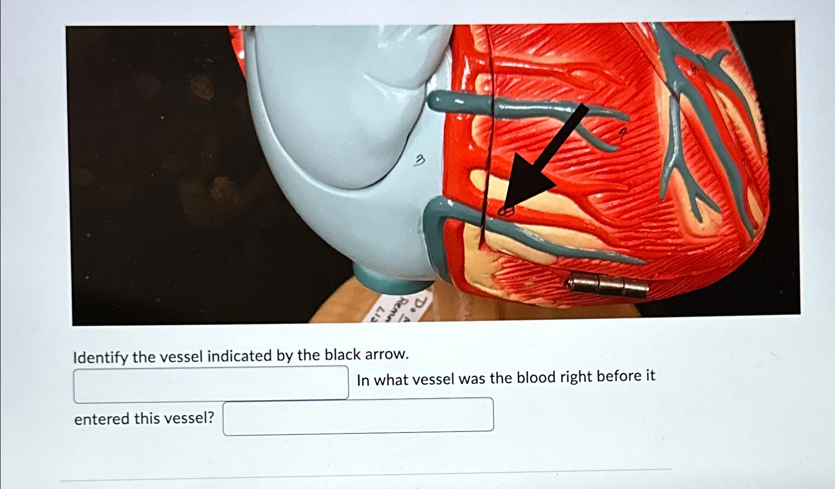 Solved Identify the vessel indicated by the black arrow.In | Chegg.com