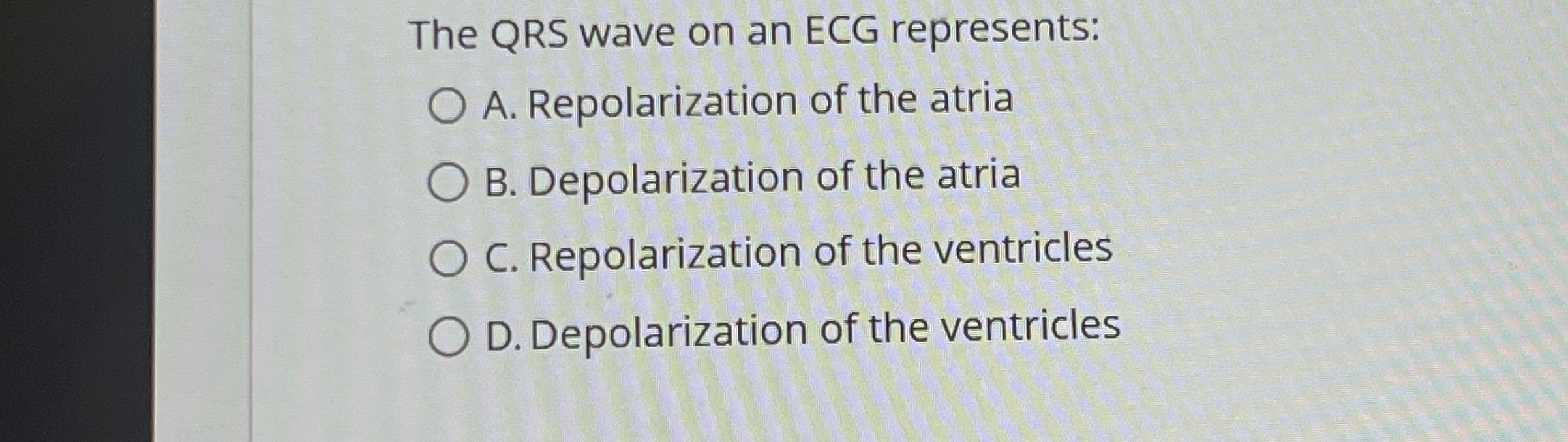 Solved The QRS wave on an ECG represents:A. ﻿Repolarization | Chegg.com