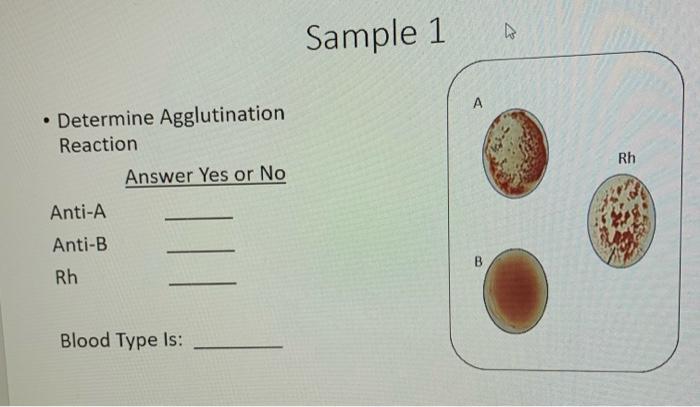 Solved Sample 2 . Determine Agglutination Reaction Answer | Chegg.com