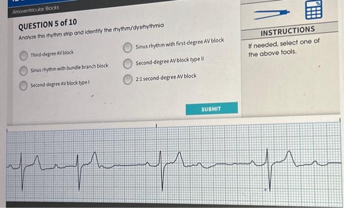 Solved Atrioventricular Blocks QUESTION 5 of 10 Analyze this | Chegg.com