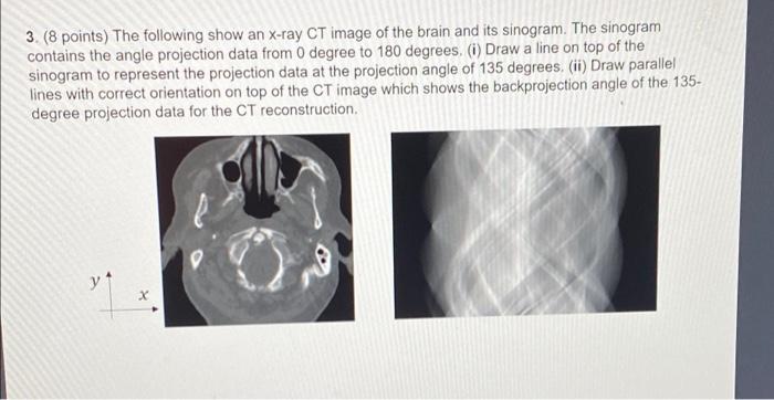 3. (8 points) The following show an X-ray CT image of | Chegg.com