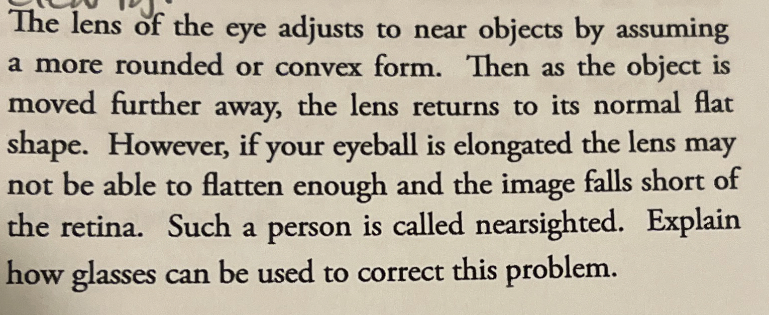 Solved The lens of the eye adjusts to near objects by | Chegg.com