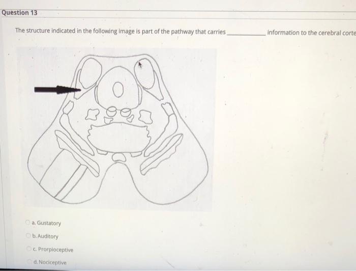 Solved Question 13 The structure indicated in the following | Chegg.com
