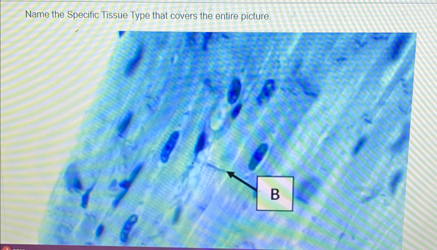 Solved Name the Specific Tissue Type that covers the entire | Chegg.com