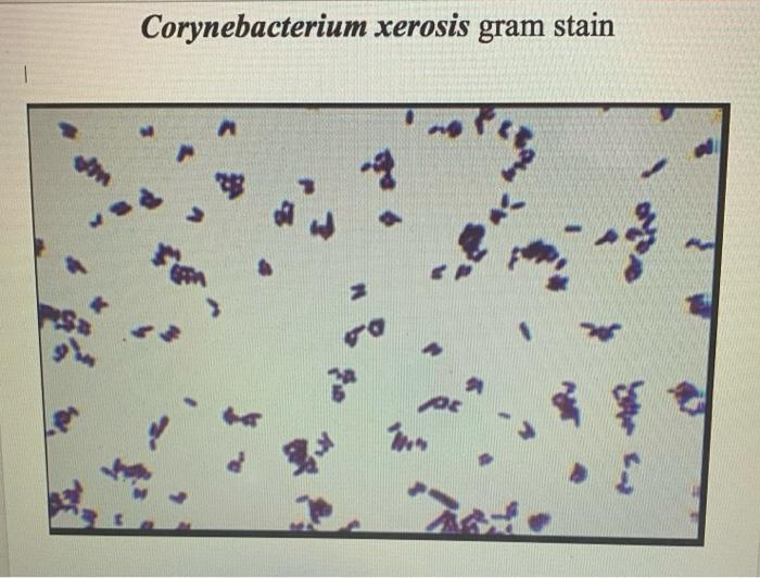 Corynebacterium Gram Stain
