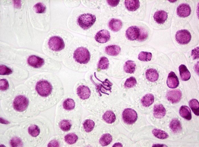 Solved Stage of the Cell Cycle Number of Cells Interphase | Chegg.com