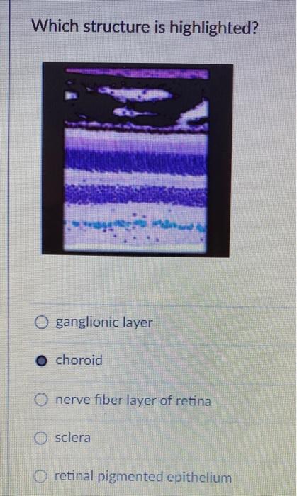 Solved What is highlighted? O vestibular membrane spiral | Chegg.com