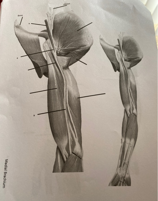 Solved 7 Medial Brachium | Chegg.com