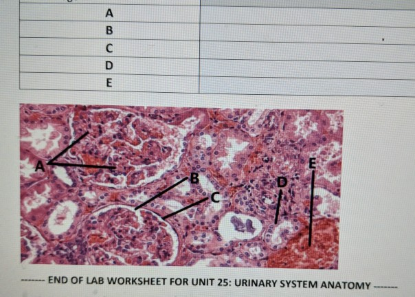 Solved А B с D E B END OF LAB WORKSHEET FOR UNIT 25: URINARY | Chegg.com