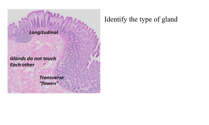Solved Identify the type of gland | Chegg.com